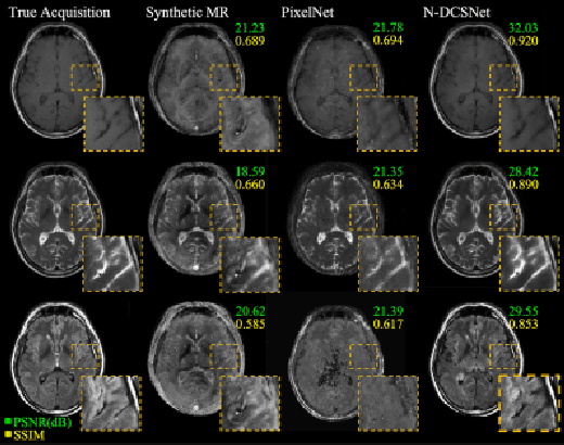 Magnetic Resonance Fingerprinting