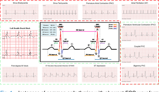 ECG-CL: A Comprehensive Electrocardiogram Interpretation Method Based on Continual Learning ...