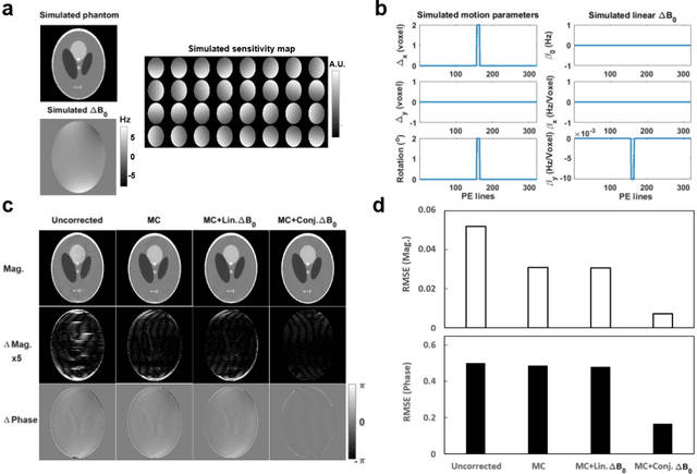 MRI motion correction: Models, code, and papers - CatalyzeX