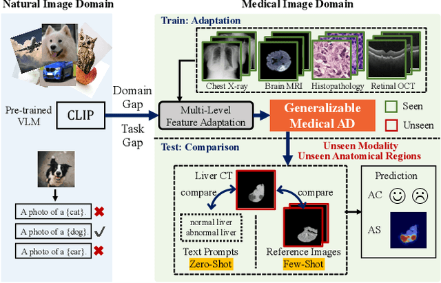 Adapting Visual-Language Models for Generalizable Anomaly Detection in ...