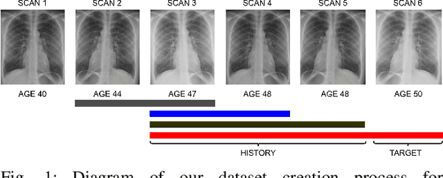 Improving Chest X-Ray Classification by RNN-based Patient Monitoring