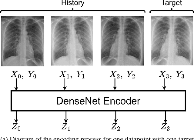Improving Chest X-Ray Classification by RNN-based Patient Monitoring