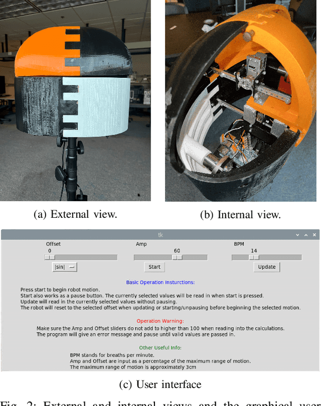 Non-contact Respiratory Anomaly Detection using Infrared Light Wave Sensing