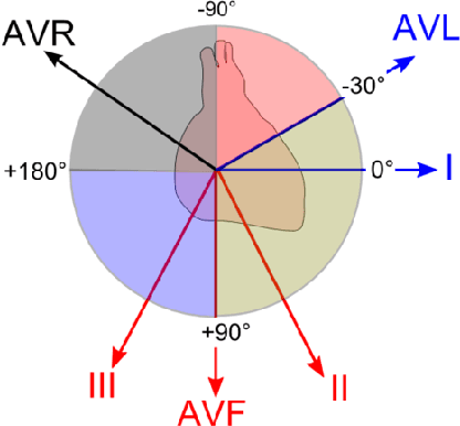 Monitoring of the heart movements using a FMCW radar and correlation ...