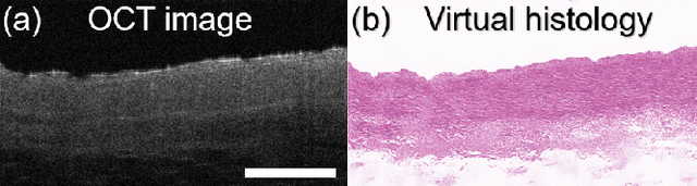 Structural constrained virtual histology staining for human coronary ...