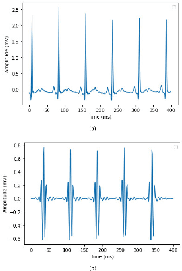 A Novel Deep Learning Based Approach For Sleep Apnea Detection Using