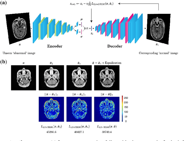 Unsupervised Brain Abnormality Detection Using High Fidelity Image