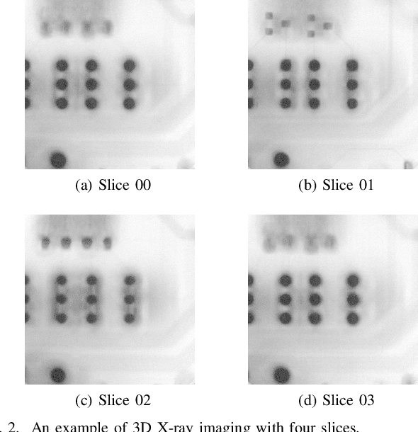 Deep Learning Based Defect Detection For Solder Joints On Industrial X