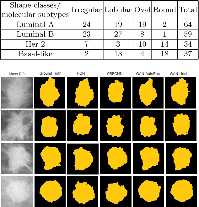Conditional Generative Adversarial And Convolutional Networks For X Ray