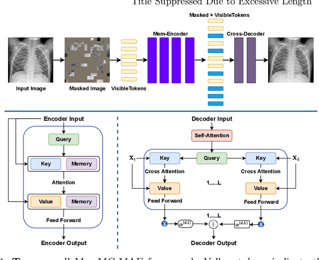 Unsupervised Anomaly Detection In Medical Images With A Memory